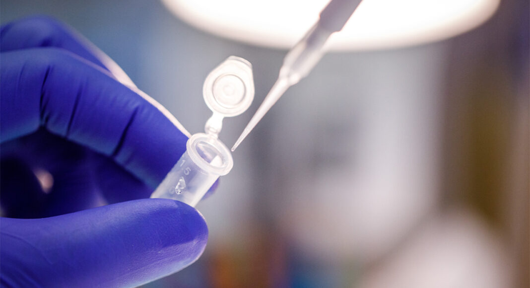 Versiti advances blood-related discoveries in fight against COVID-19